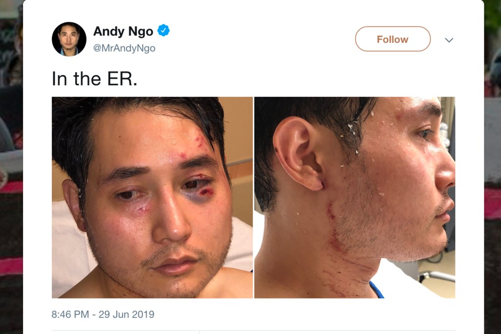 Rep. Swalwell's response to the Andy Ngo beating could be a lot worse